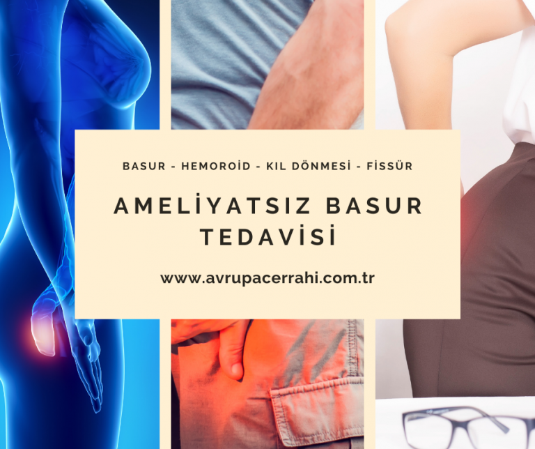 Ameliyatsız Basur Nasıl Tedavi Edilir? - Kişisel Bilgi